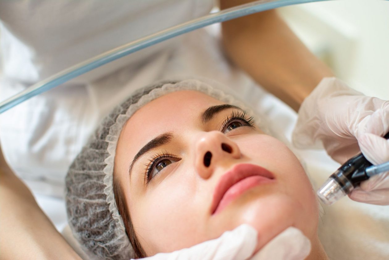 What Is Microchanneling And What Are The Benefits? - Onyeka Tefari ...